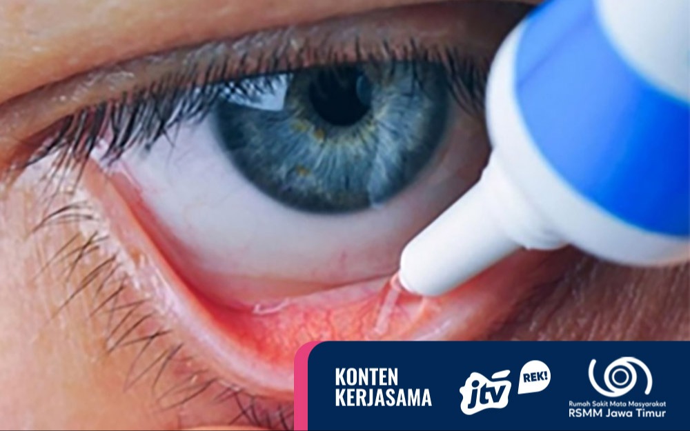 Memilih Pelembab Mata Terbaik untuk Mata Kering - Portal JTV